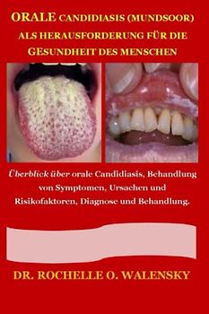 ORALE CANDIDIASIS (MUNDSOOR) ALS HERAUSFORDERUNG FÜR DIE GESUNDHEIT DES ...