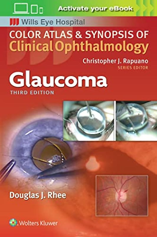 Glaucoma (Color Atlas and Synopsis of Clinical Ophthalmology) (Wills Eye Hospital Color Atlas ...