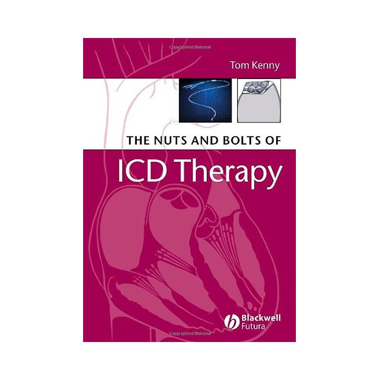The Nuts and Bolts of ICD Therapy (Nuts & Bolts Series) - Kenny, Tom ...